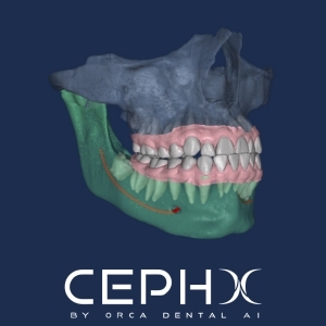 AI Services: Automatic Cephalometric Analysis | cephX