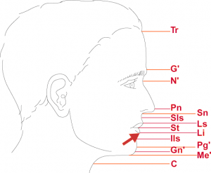 Cephalometric Analysis | Cephx