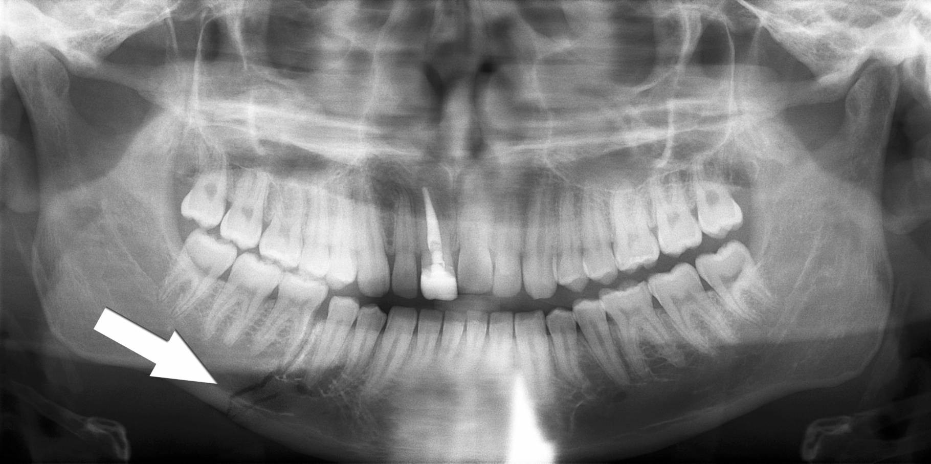 Cephalometry in Orthodontics