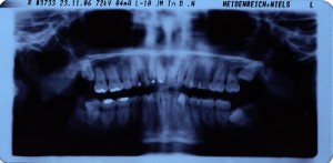 CBCT Analysis & Orthodontic Records - CephX | AI Driven Dental Services